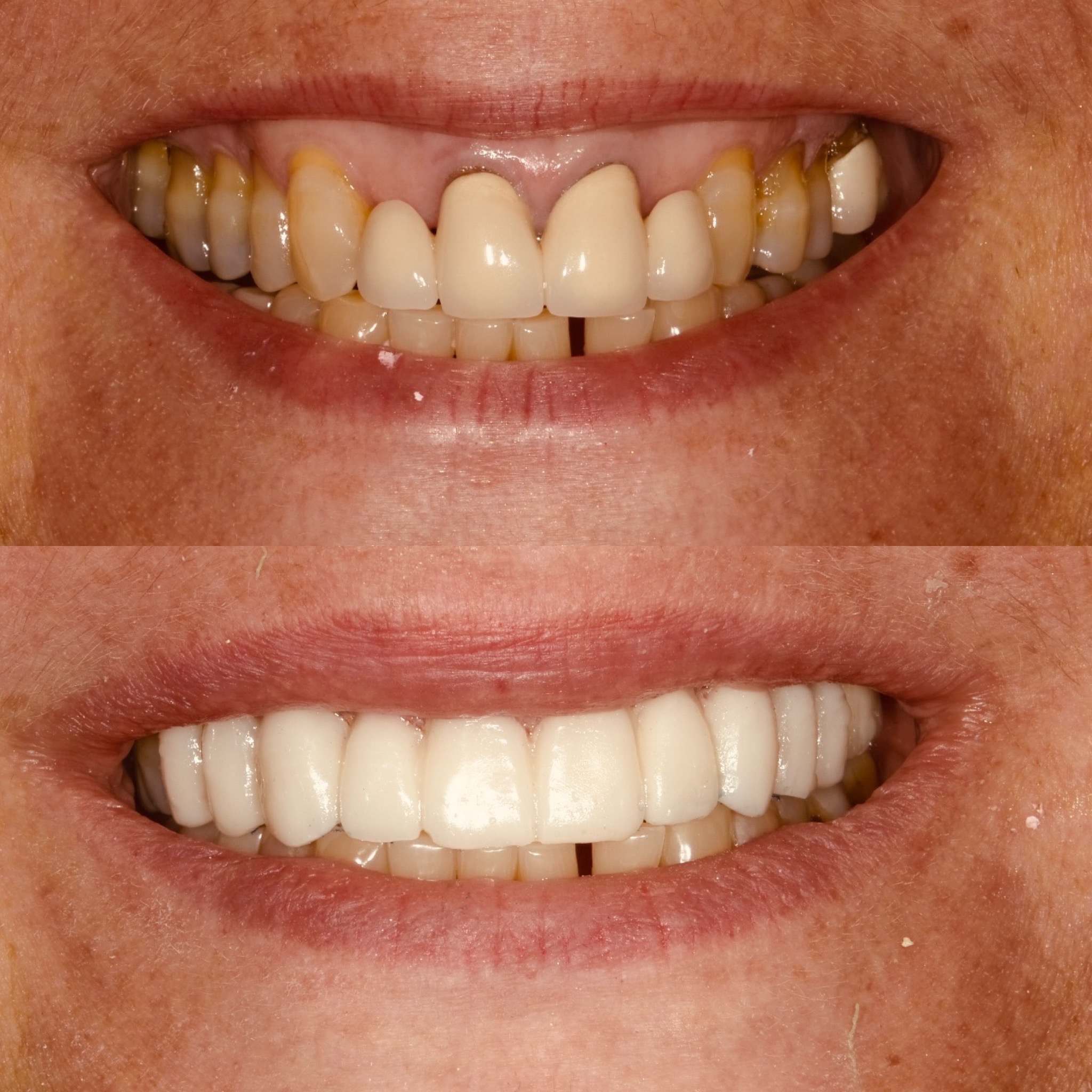 A Smile Makeover Could Change Your Life: 5 Reasons Why - Konstantine ...